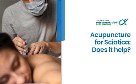 Acupuncture For Sciatica Does It Help