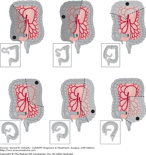 Asce 7 10 Chapter 30 Pdf File Managervisa