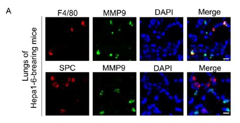 Mouserabbit Triple Target Four Color Fluorescence Detection Kit