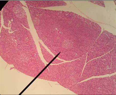 人胰腺（示胰岛） 人组织学切片 产品中心 新乡市求精教学仪器有限公司
