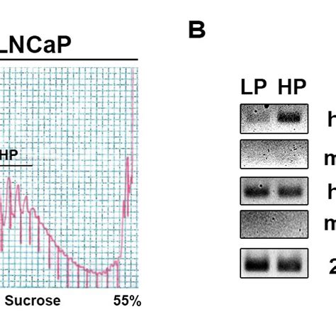 Representative Polyribosome Profiles Obtained From Xenografts Samples