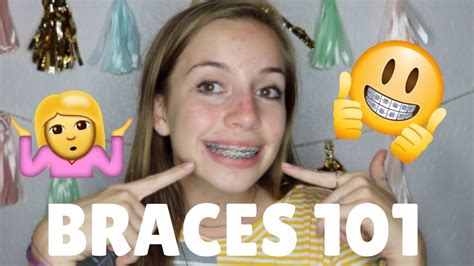 Braces 101 Youtube