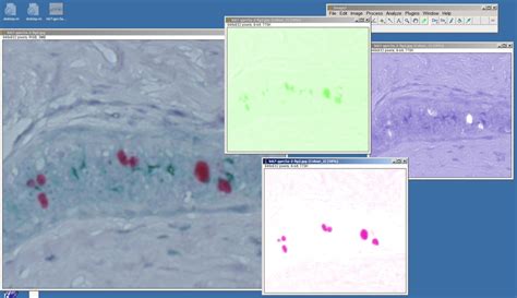 is it possible to quantify overlapping green and red stains in