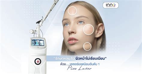 รักษาหลุมสิว ผิวหน้าไม่เรียบเนียน ด้วยเลเซอร์ยอดนิยม Pico Laser