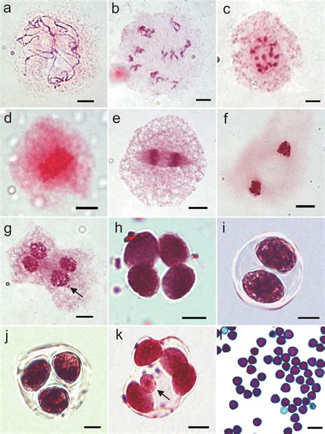 Meiosis Observed In Bushy Matgrass A Pachytene B Diplotene With