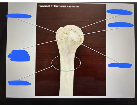 Proximal R Humerus Quiz