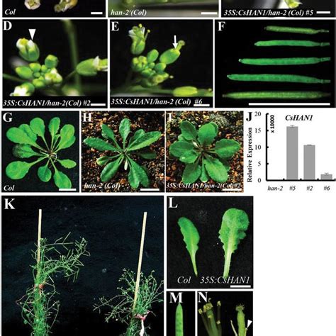 Ectopic Expression Of Cshan1 In Han 2 Mutant And Wild Type Arabidopsis Download Scientific