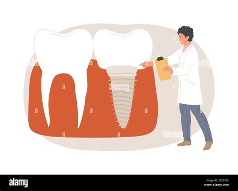 Teeth Dentures Implants Isolated Concept Vector Illustration Denture