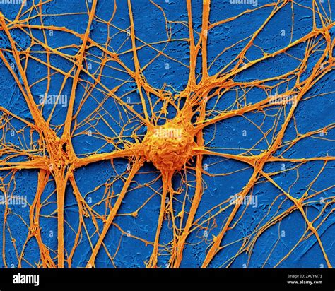 Stem Cell Derived Neuron Coloured Scanning Electron Micrograph Sem Of A Human Nerve Cell