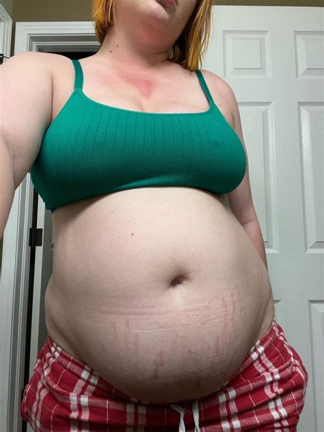 Do I Have More Stretch Marks Jadeobsidian On Tumblr