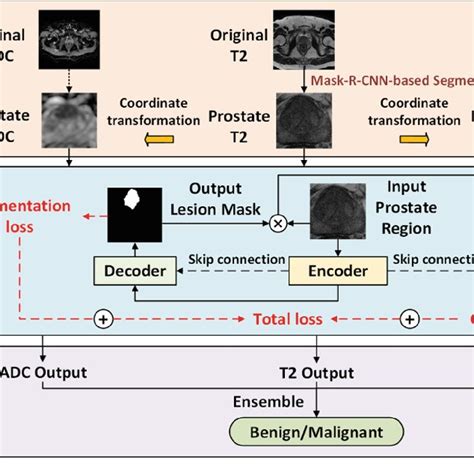 Schematics Of The Proposed Automated Prostate Lesion Download Scientific Diagram