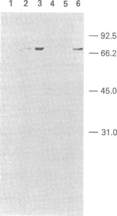 Figure 1 From The Chromosome 14 Breakpoint In Neoplastic B Cells With