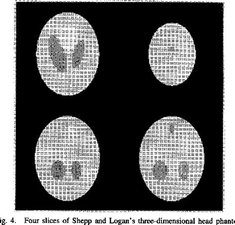 Figure 1 From A General Cone Beam Reconstruction Algorithm Semantic Scholar