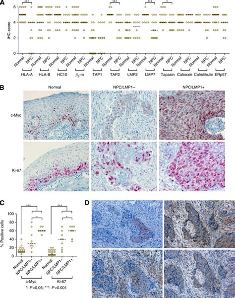 Down Regulation Of Hla Class I Apm Components In Npc And Up Regulation