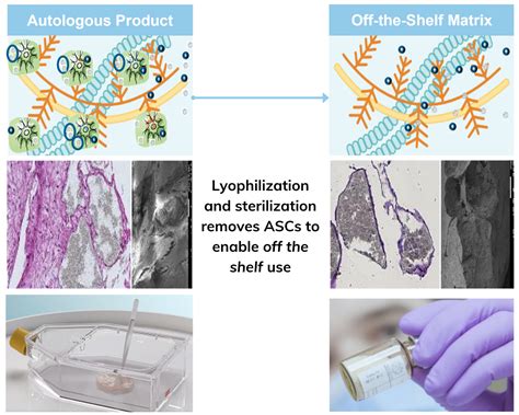 Nvd X3 Novadip For Common Orthopedic Conditions