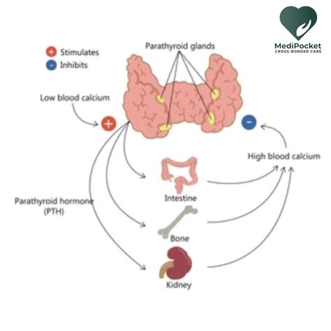 Primary Hyperparathyroidism Causes And Treatments