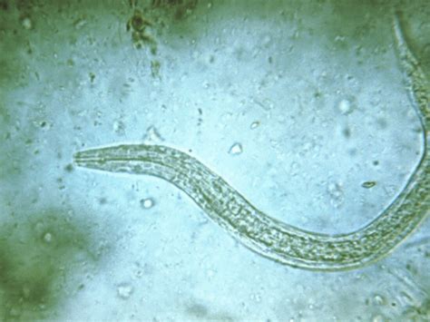 Could You Fight Off Worms Depends On Your Gut Microbes Goats And