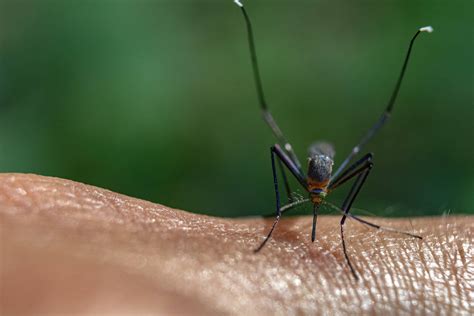 Skeeter Syndrome Mosquito Bite Symptoms And Treatment Stc