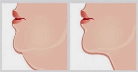 How To Get Rid Of Your Double Chin With Simple Exercises