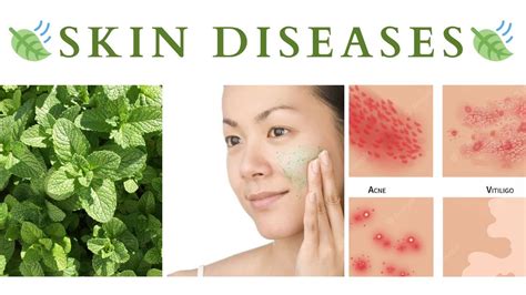 Weirdest Skin Diseases