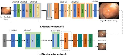 Electronics Free Full Text Colorectal Polyp Detection Model By Using Super Resolution