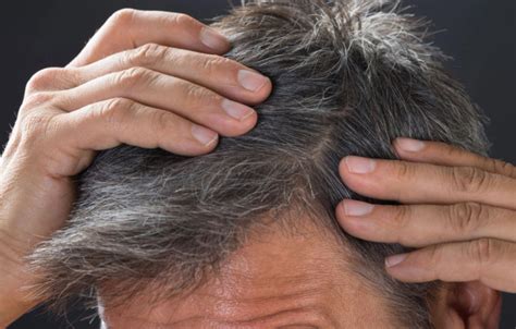 Stresi Dhe Thinjat E Flokëve Si Mund Ta Riktheni Ngjyrën E Tyre Tv21