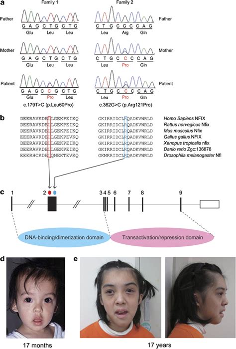 Missense Mutations In Nfix In Individuals With Sotos Like Features A