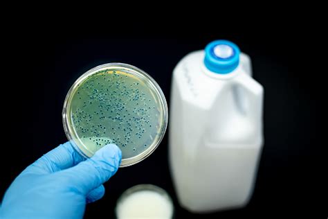 Free Picture Colonial Morphology Exhibited Colonies Brucella Abortus Bacteria