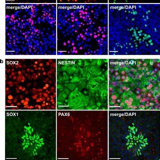 Three Germ Layer Differentiation Potential Of NWR IPSCs See Also