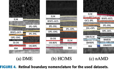 Figure 1 From Interactive Deep Learning Based Retinal Oct Layer Segmentation Refinement By