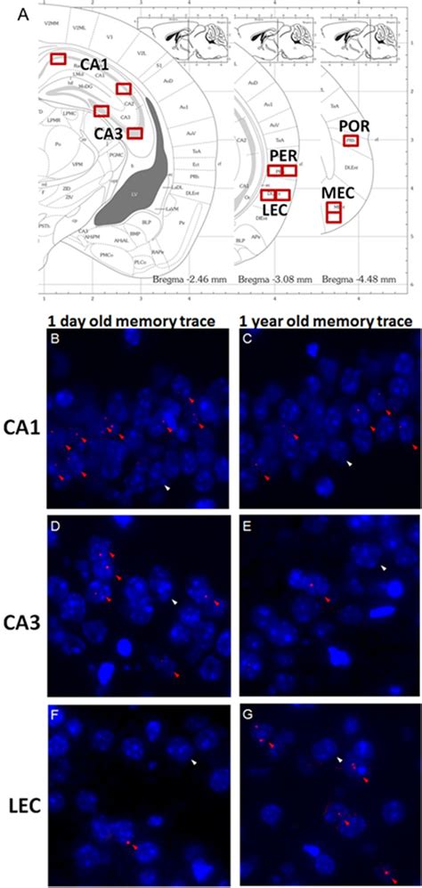 Figures And Data In Imaging A Memory Trace Over Half A Life Time In The Medial Temporal Lobe