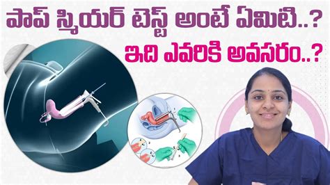 What Is Pap Smear Test Survical Cancer Detection Screening Test Avni Fertility Andrology