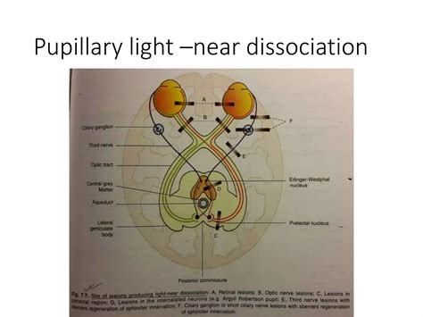 Pupillary Pathway Pptx