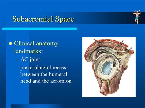 Subacromial Injection