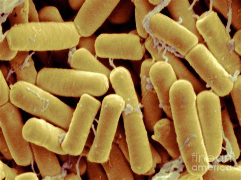 Bacillus Thuringiensis Photograph By Scimat Fine Art America