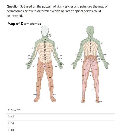 Dermatomes Leg Diagram Patient