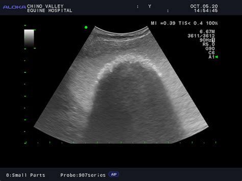 Cystic Calculus In A Mare Due To A Misplaced Uterine Glass Marble