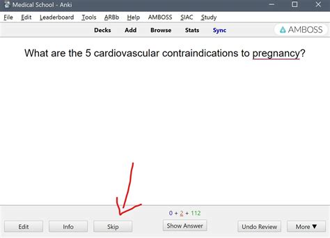 闪卡复习时支持跳过 · Issue 7697 · Siyuan Notesiyuan · Github