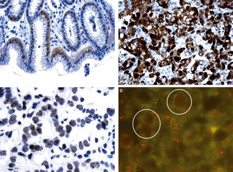 A 4b5 Immunohistochemistry Ihc Background Staining In Foveolar Download Scientific Diagram