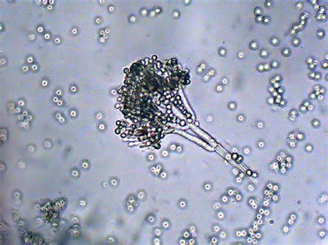 Penicillium Microscopic