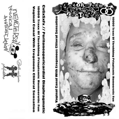 Split W Chloroform Gay Sex Fantasies Peritoneopericardial Diaphragmatic Crushed Embryo