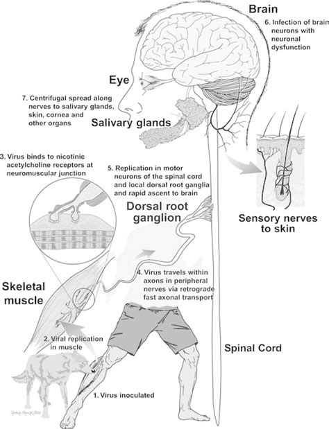 Schematic Diagram Showing The Sequential Steps In The Pathogenesis Of Download Scientific