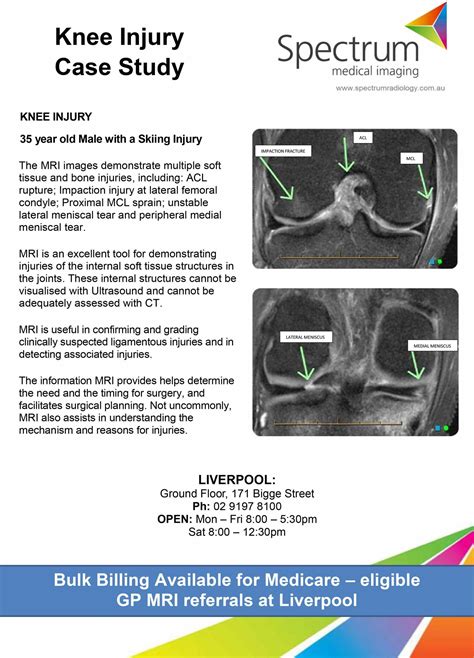 Knee Mri The Best Investigation To Elucidate The Diagnosis Gp Voice