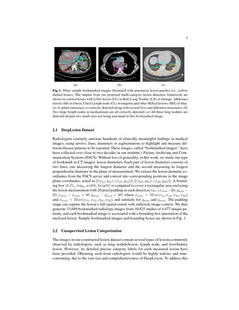 deeplesion automated deep mining categorization and detection of