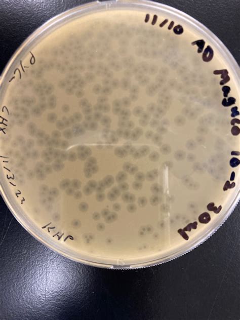 Plaque Assay Agar Plate Showing Maguco Plaque Morphology Download