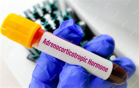 Premium Photo Adrenocorticotropic Hormone Acth Test Acth Regulates