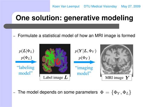 Ppt Generative Models For Automated Brain Mri Segmentation Powerpoint