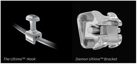 Ormco Brings You Spark Clear Aligners And Damon Ultima As Its Latest