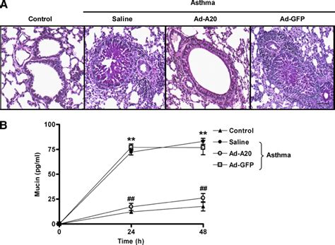 Microscopic Findings Of The Intrapulmonary Bronchi A Paraffin