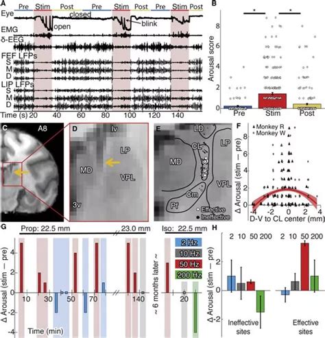 Scientists Switch Monkey Brains On Or Off Using Electricity In Experiment Daily Star